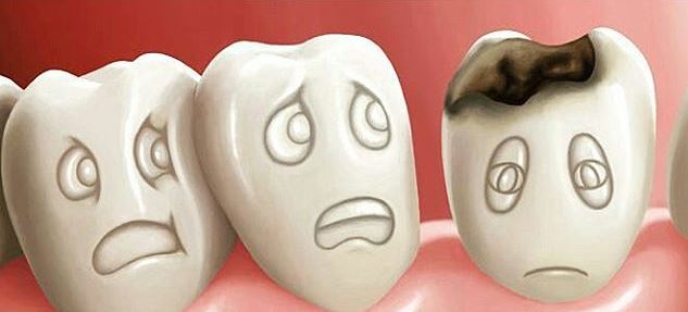 ¡Peligro! Una muela rota te puede ocasionar otras enfermedades | Fusión ...